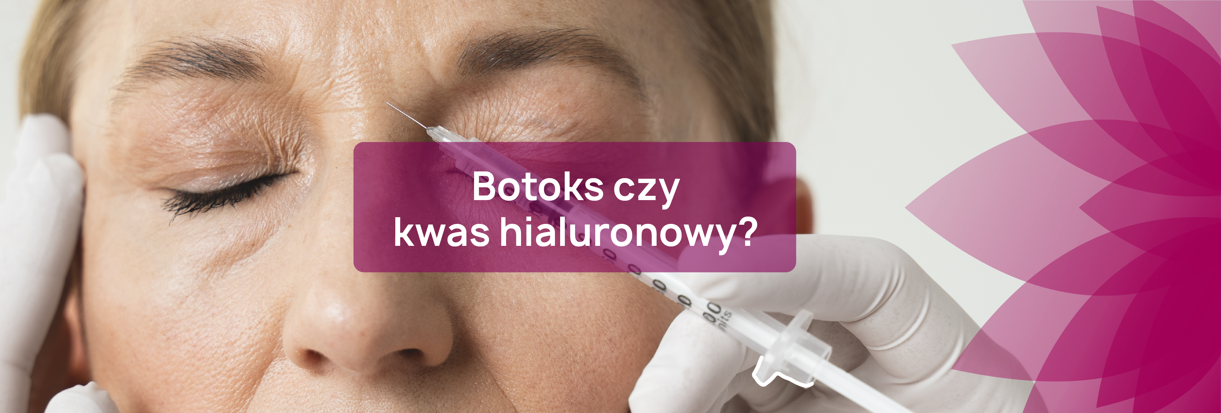 Botoks czy kwas hialuronowy co lepsze? · PerfectLift